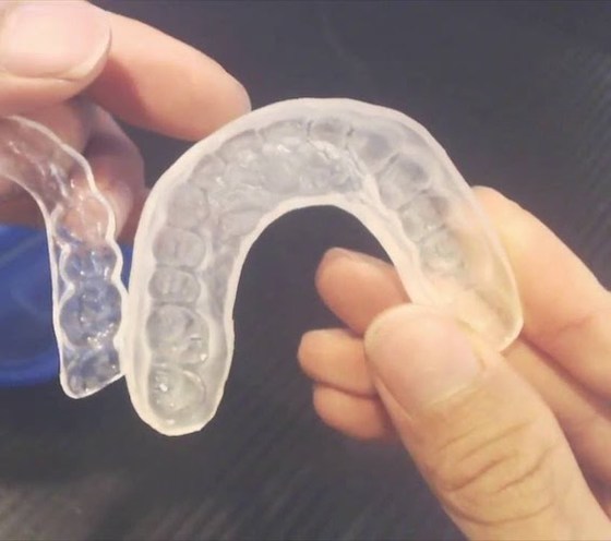 5 Best Night Guards - July 2018 - BestReviews